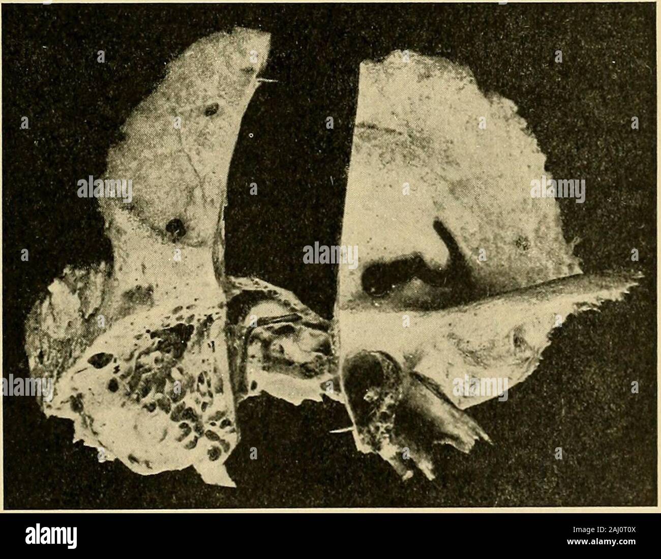 Transverse section showing relation hi-res stock photography and images ...