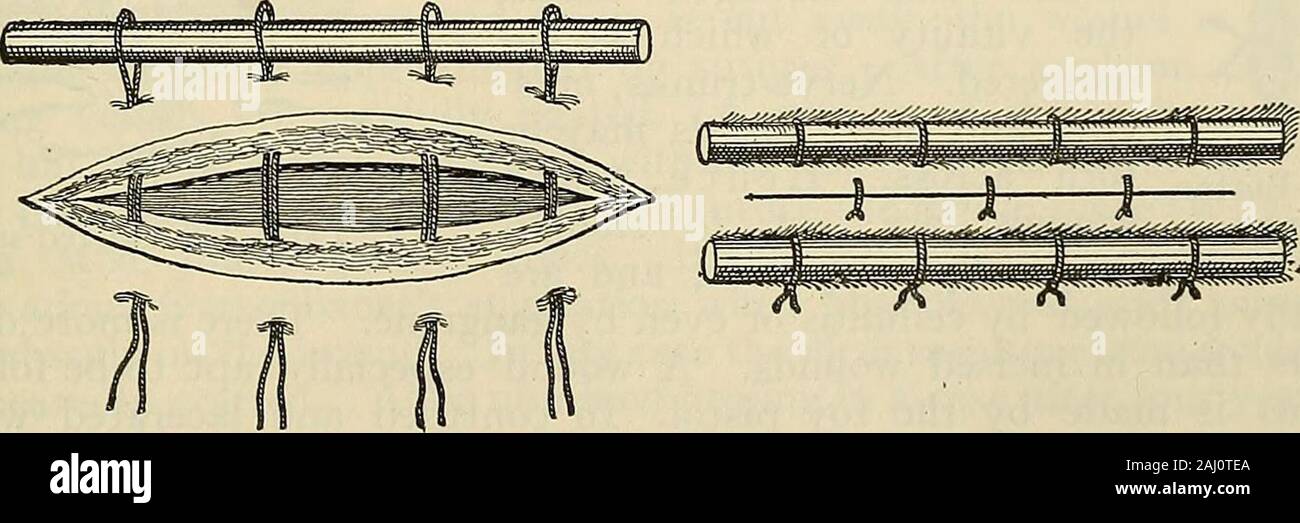 Modern surgery, general and operative . Fig. 119.—Halsteds subcuticular ...