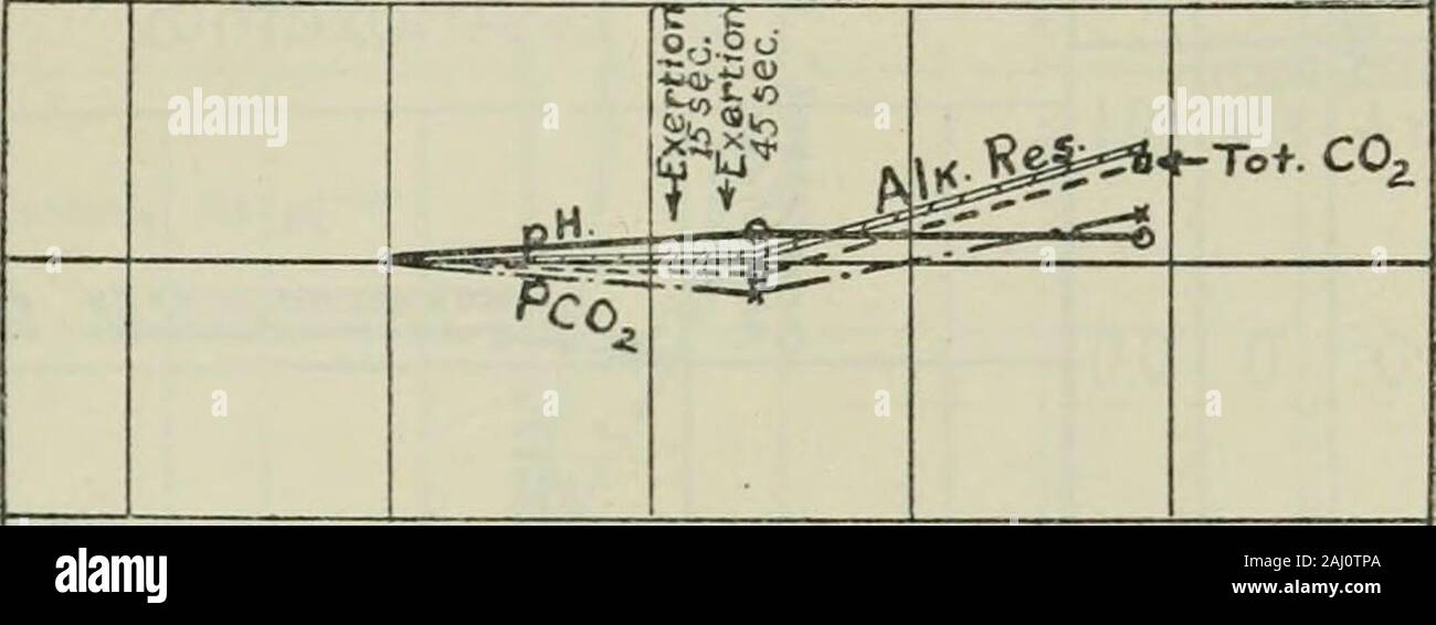Chloroform anesthesia hi-res stock photography and images - Alamy