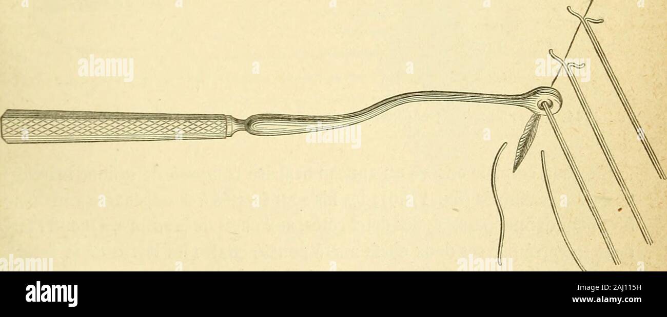 Arsenal de la chirurgie contemporaine : description, mode d'emploi, et ...