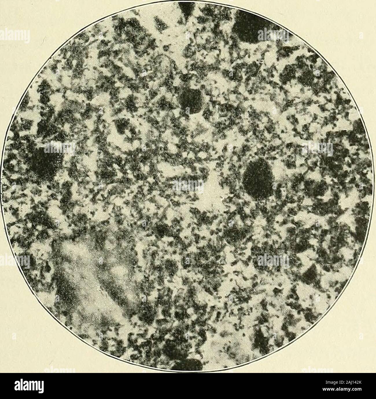 Diplococci bacteria hi-res stock photography and images - Alamy