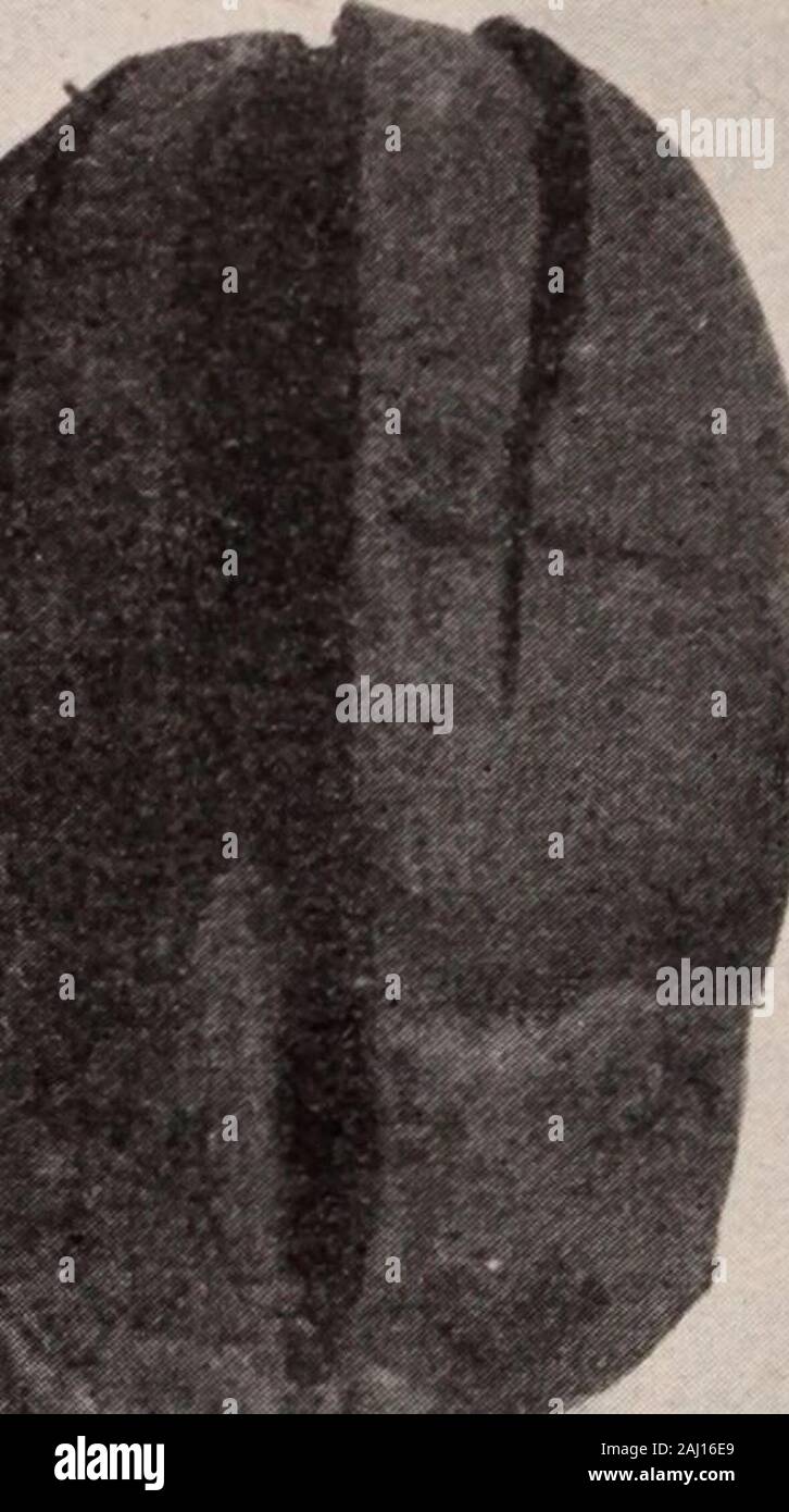 Stuporous Definition Medical