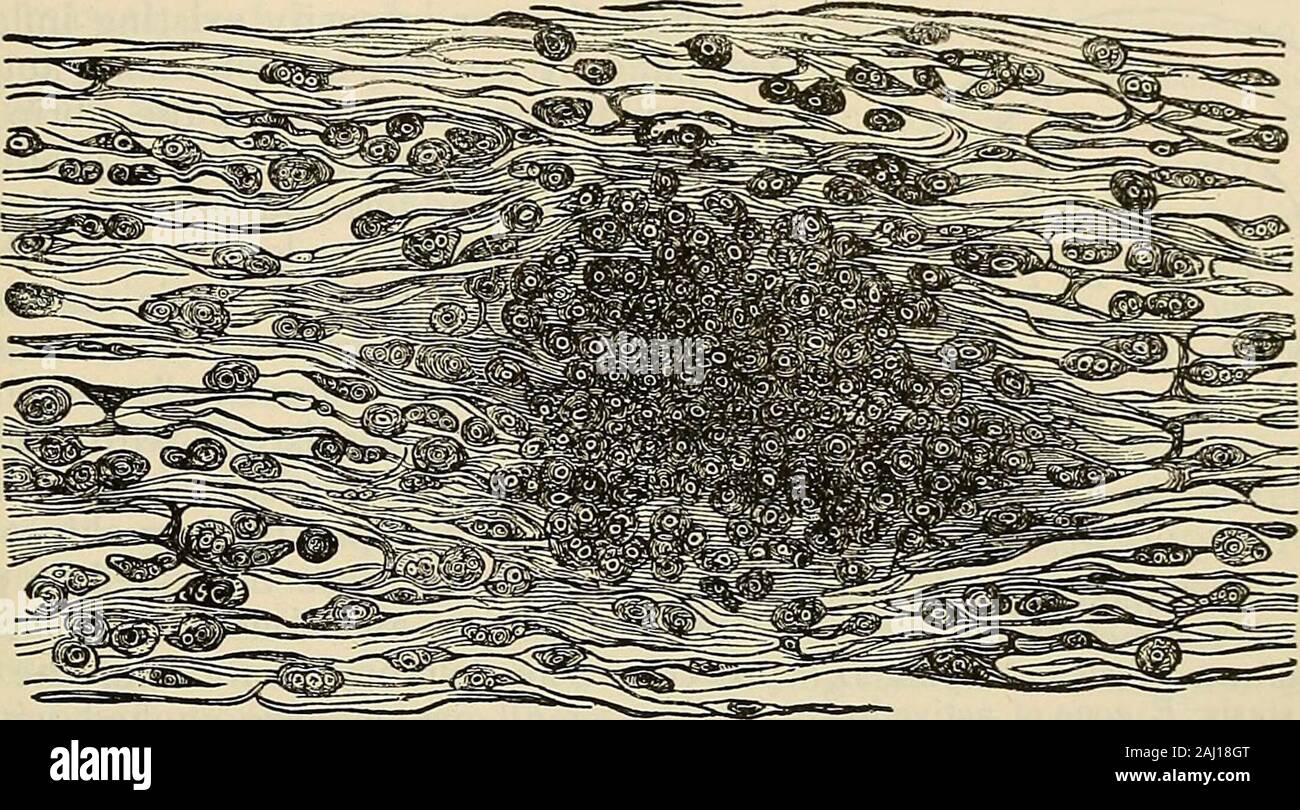 Bloody Tissues High Resolution Stock Photography and Images - Alamy