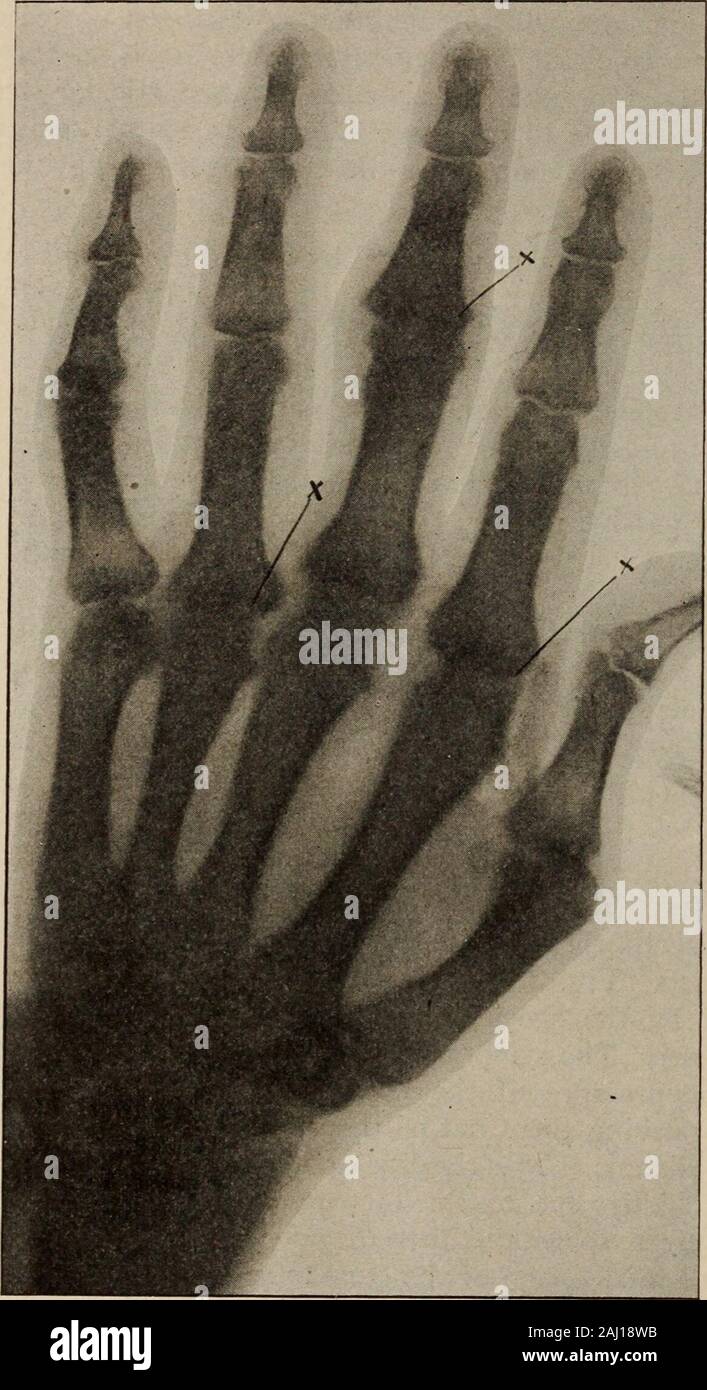 Buffalo medical journal . e oc-casionally see. The symptoms of ...