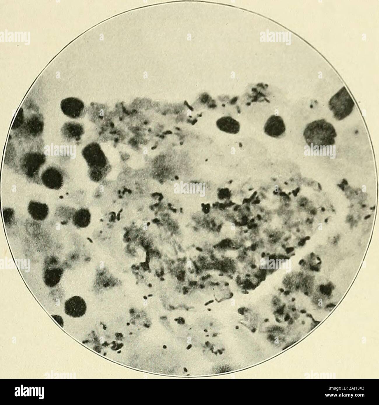 Diplococci bacteria hi-res stock photography and images - Alamy