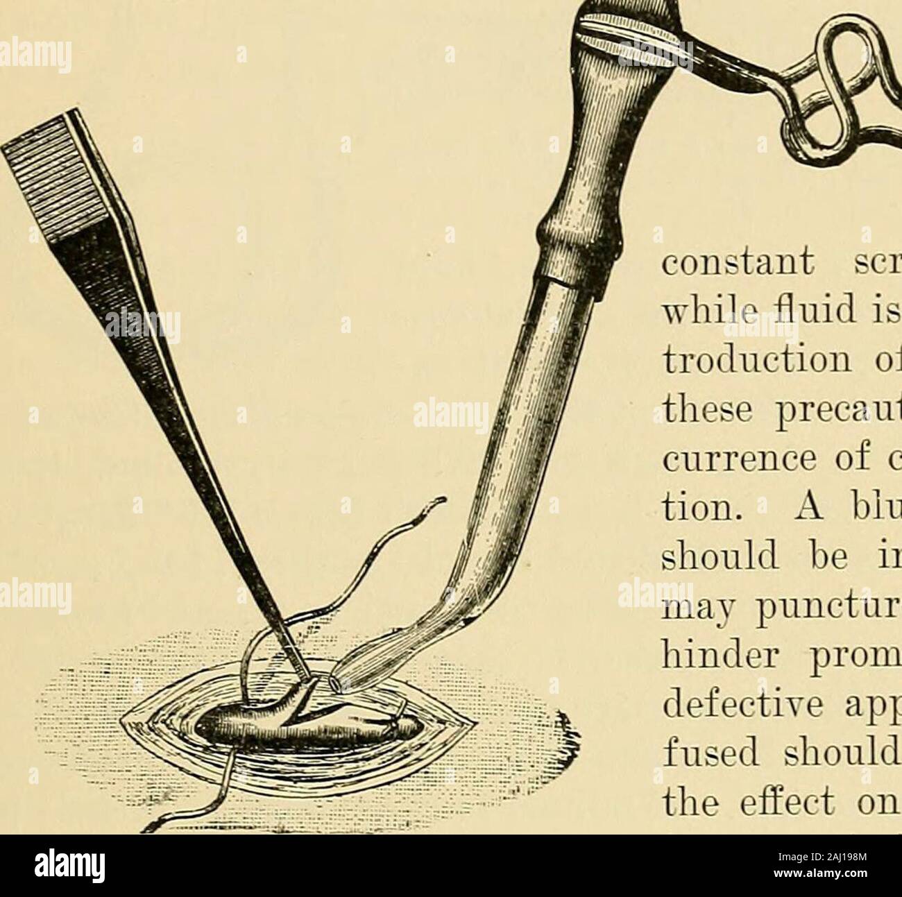 Operative surgery . the case andthe effect on the patient, from a ...