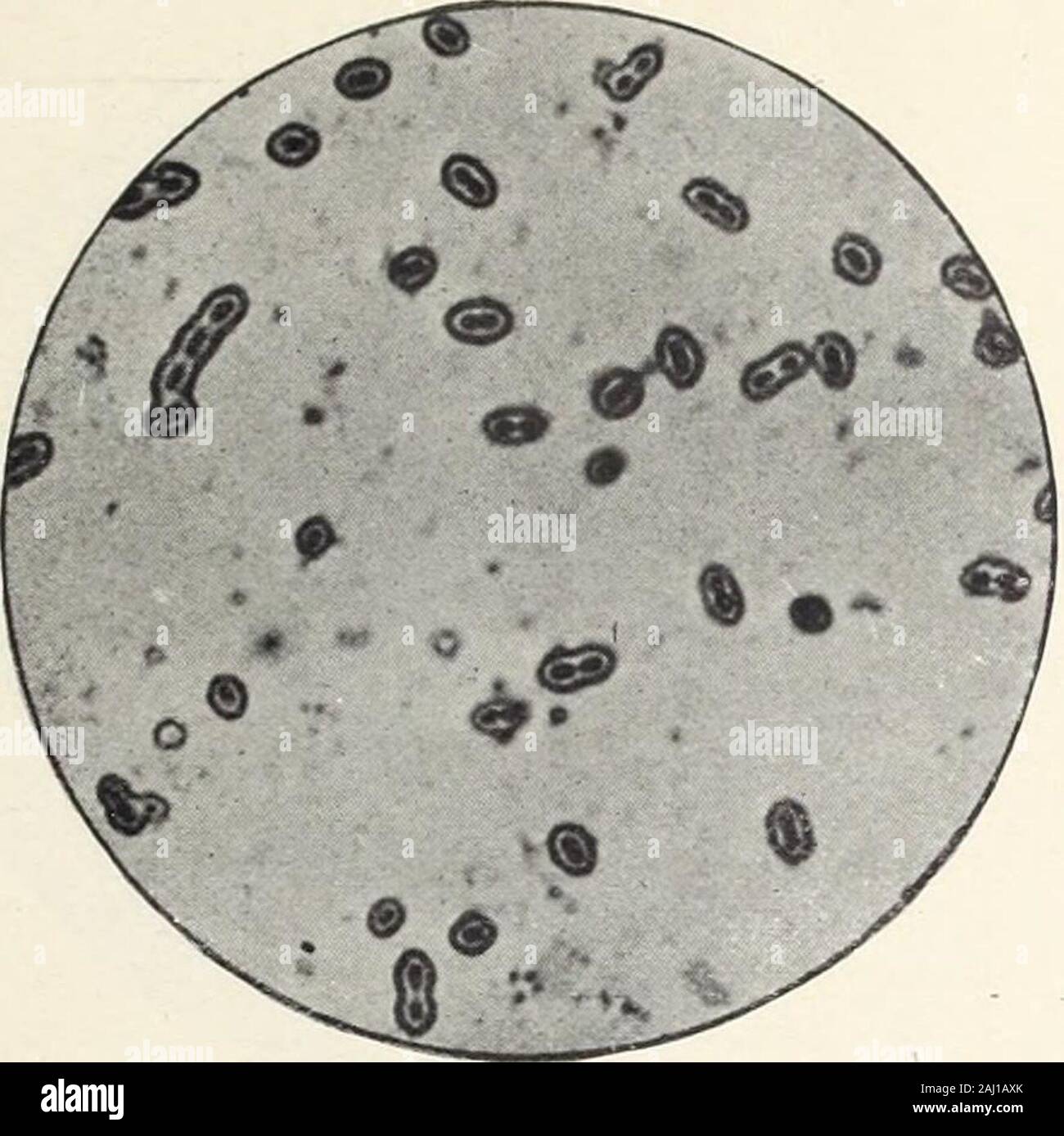 Streptococcus Salivarius Capsule Stain