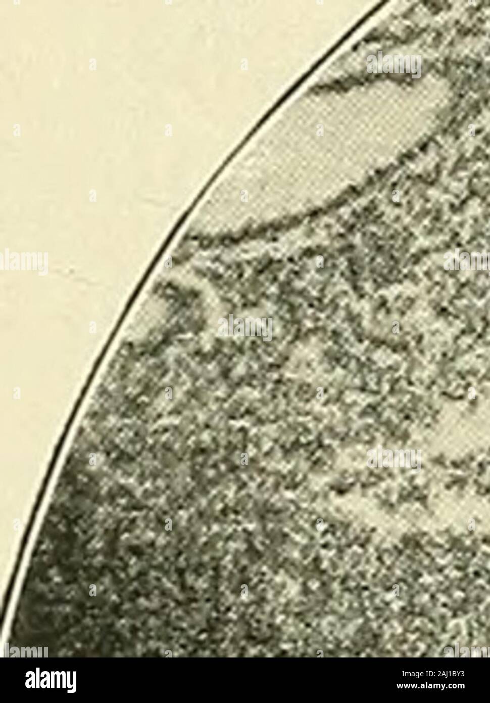 Lymphoid follicles hi-res stock photography and images - Alamy
