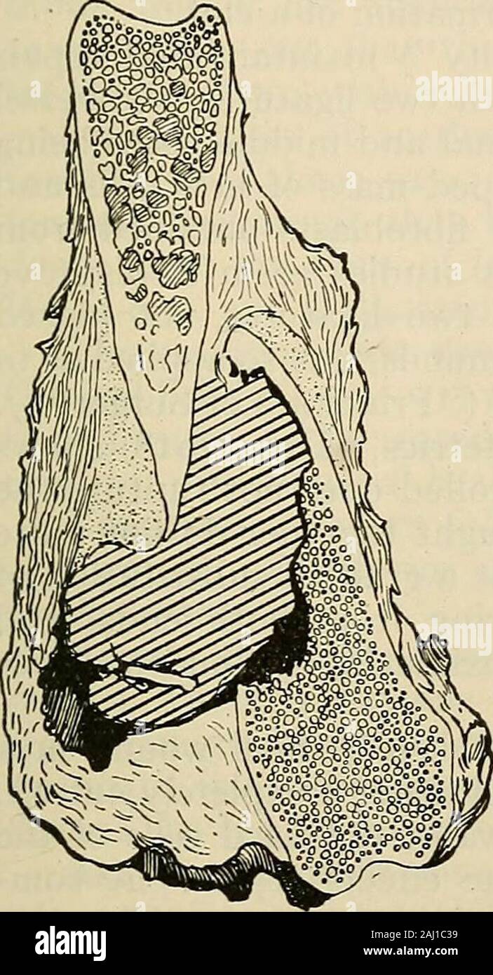 Stripped to the bone hi-res stock photography and images - Alamy