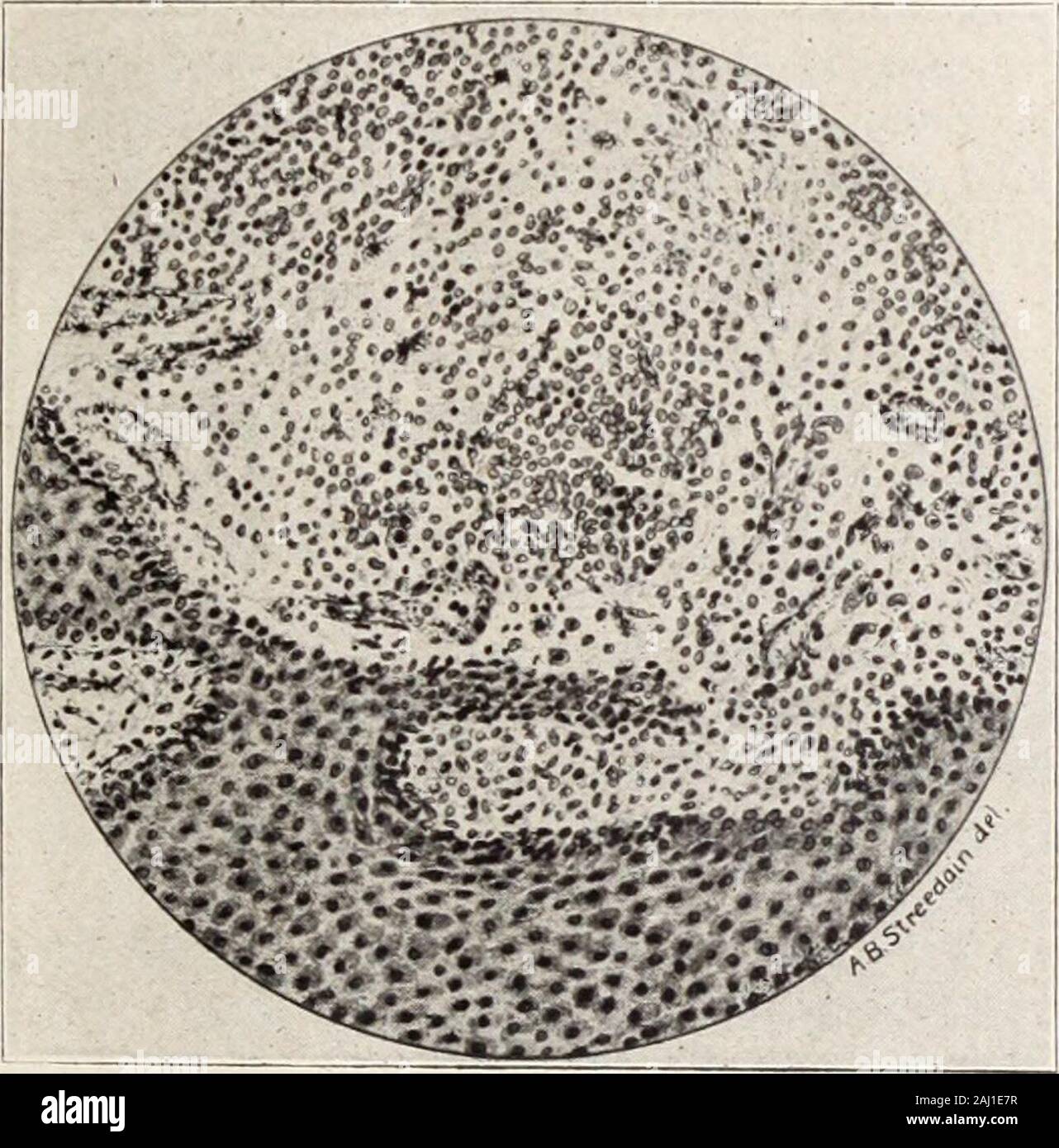 Internal feces hi-res stock photography and images - Alamy