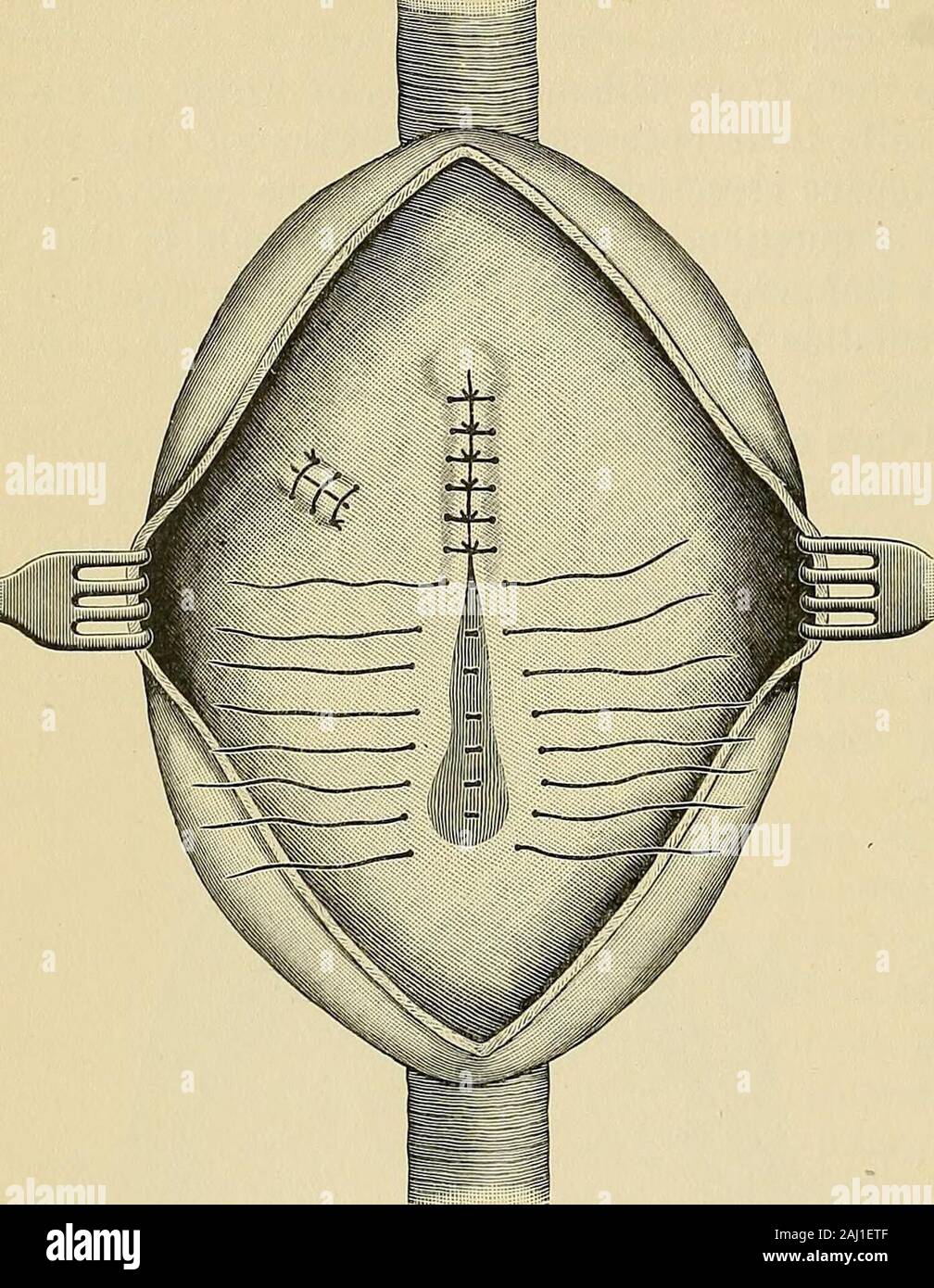 Operative surgery . * Transactions of American Surgical Association ...