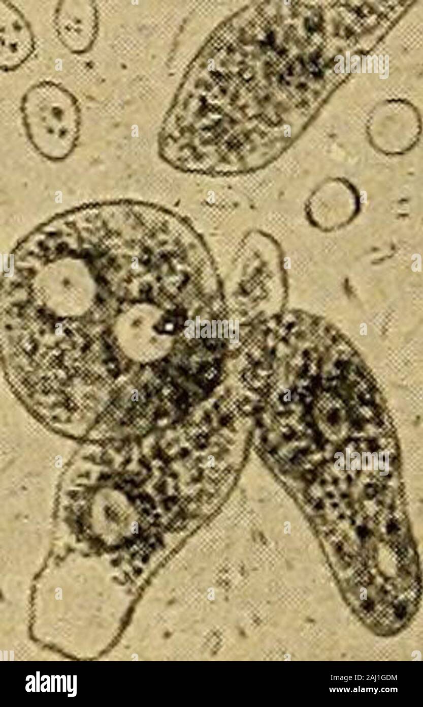 Bacillary dysentery hi-res stock photography and images - Alamy