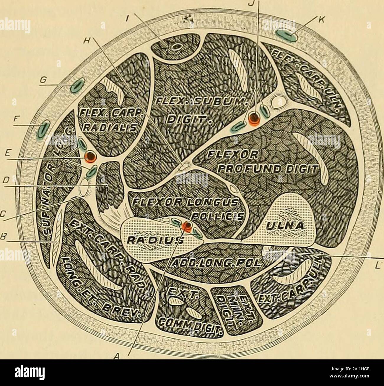 Operative surgery . Fig. 224.—Transverse section of right forearm at ...