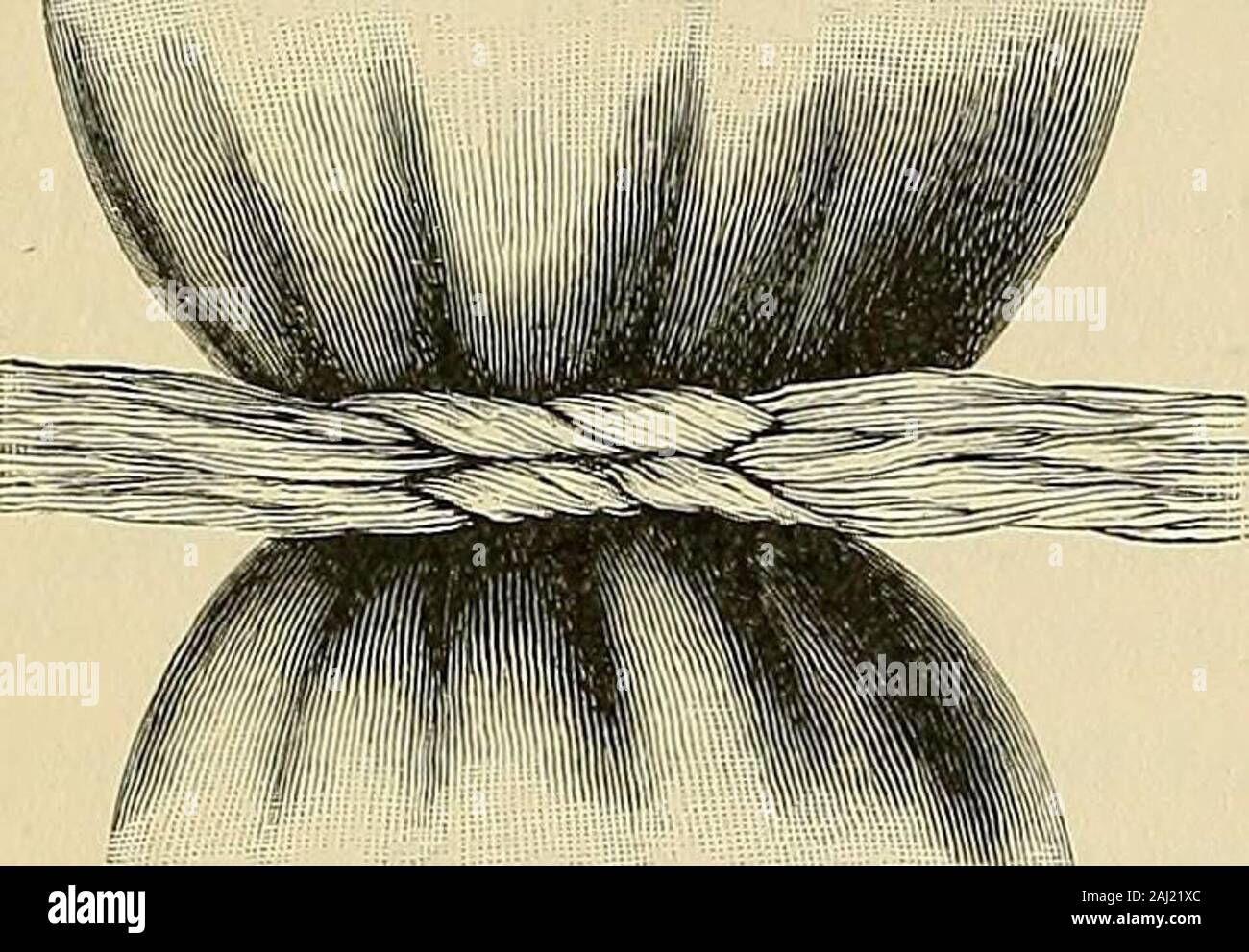 Operative surgery . ns of the sterno-mastoids, bothsterno-thyroid and ...