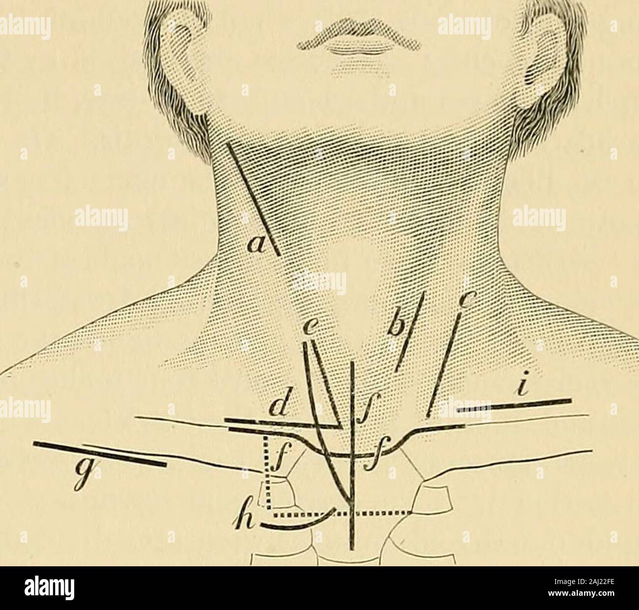 Operative surgery . eportions of the sterno-cleido-mastoid muscle ...