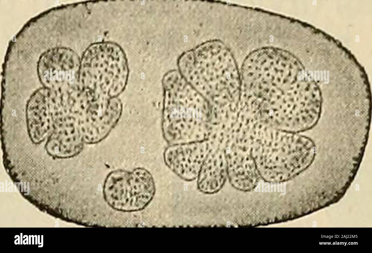 Modern surgery, general and operative . Fig. 6.—Sarcinae forming bales ...