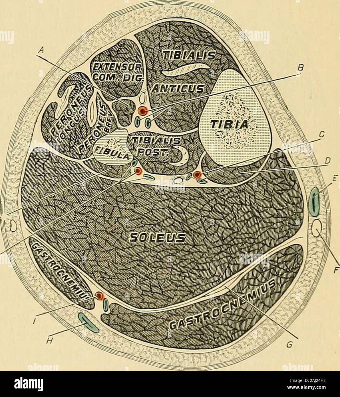 Operative surgery . of the extensorproprius hallucis (Fig. 202). Tlie ...