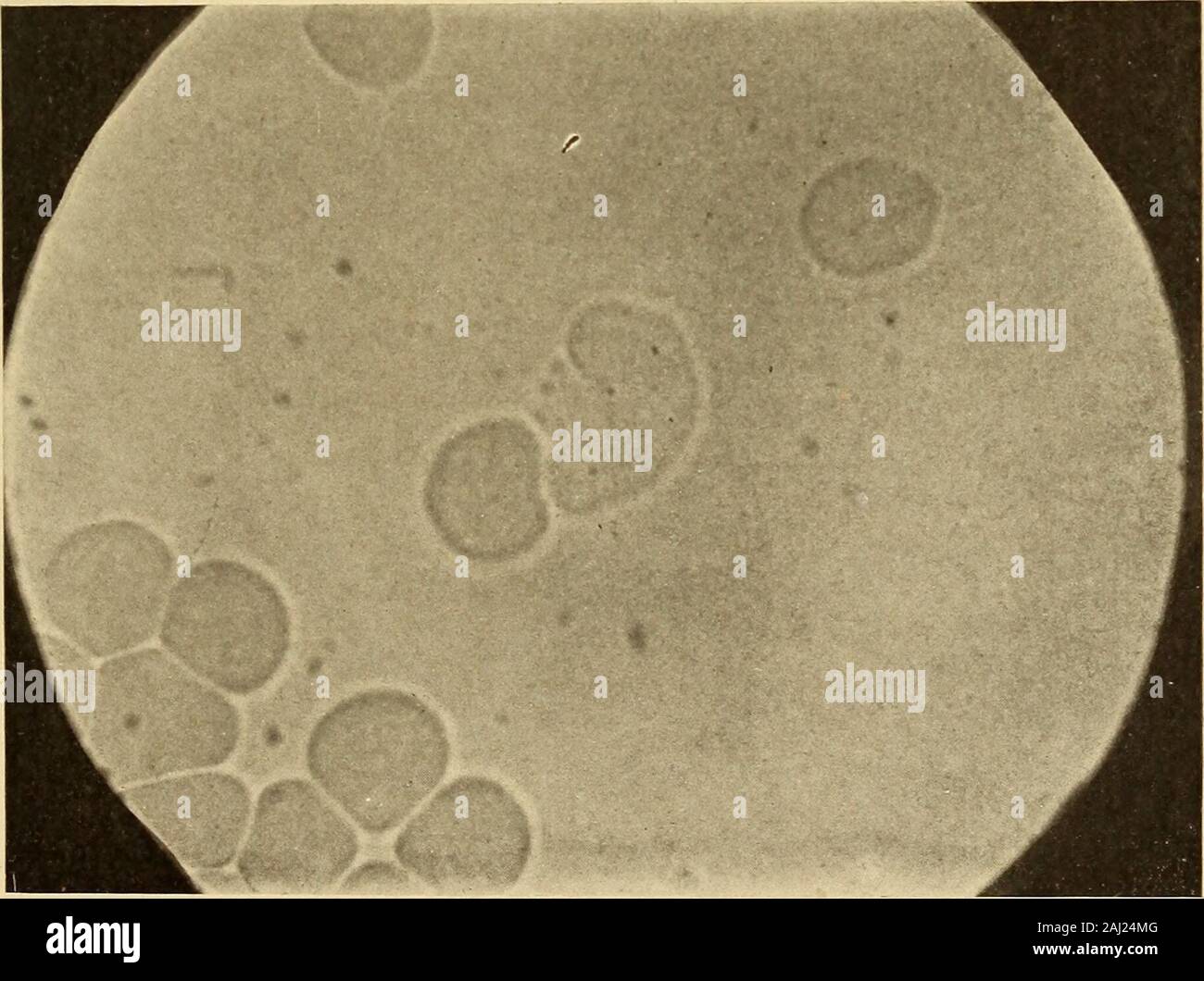 Globin hi-res stock photography and images - Alamy