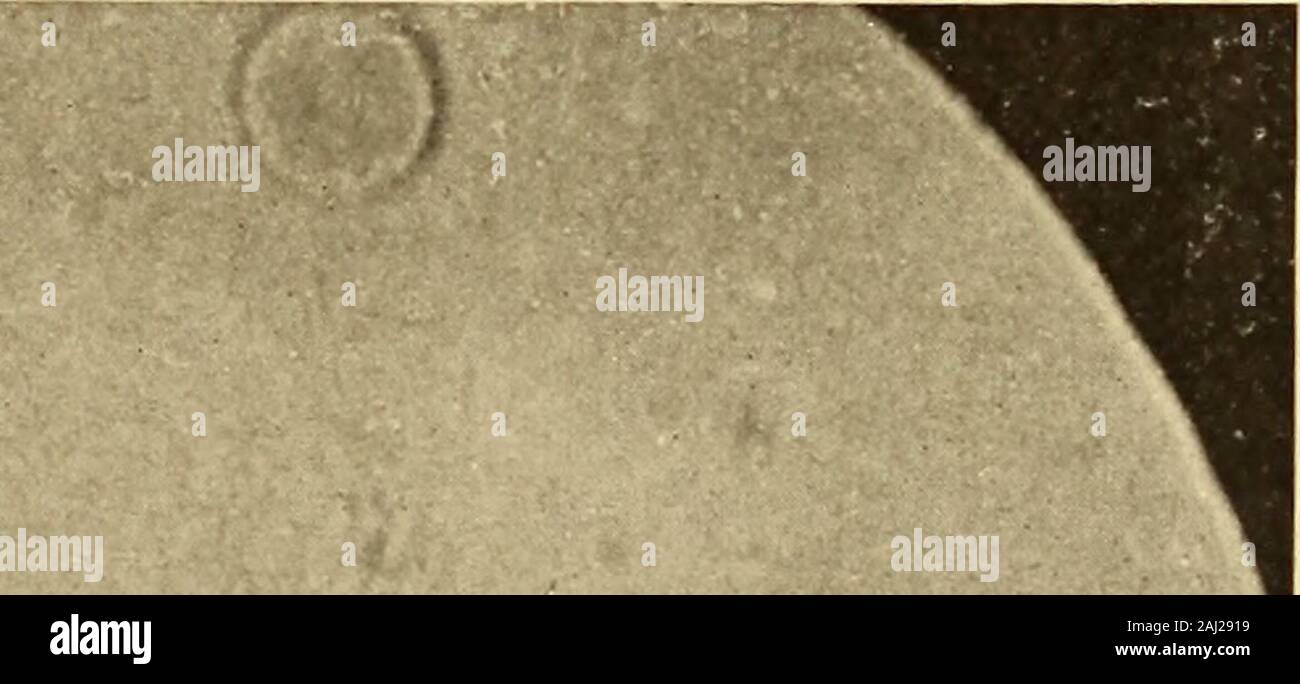 Induced cell-reproduction and cancer.. . ?HHBH Stock Photo - Alamy