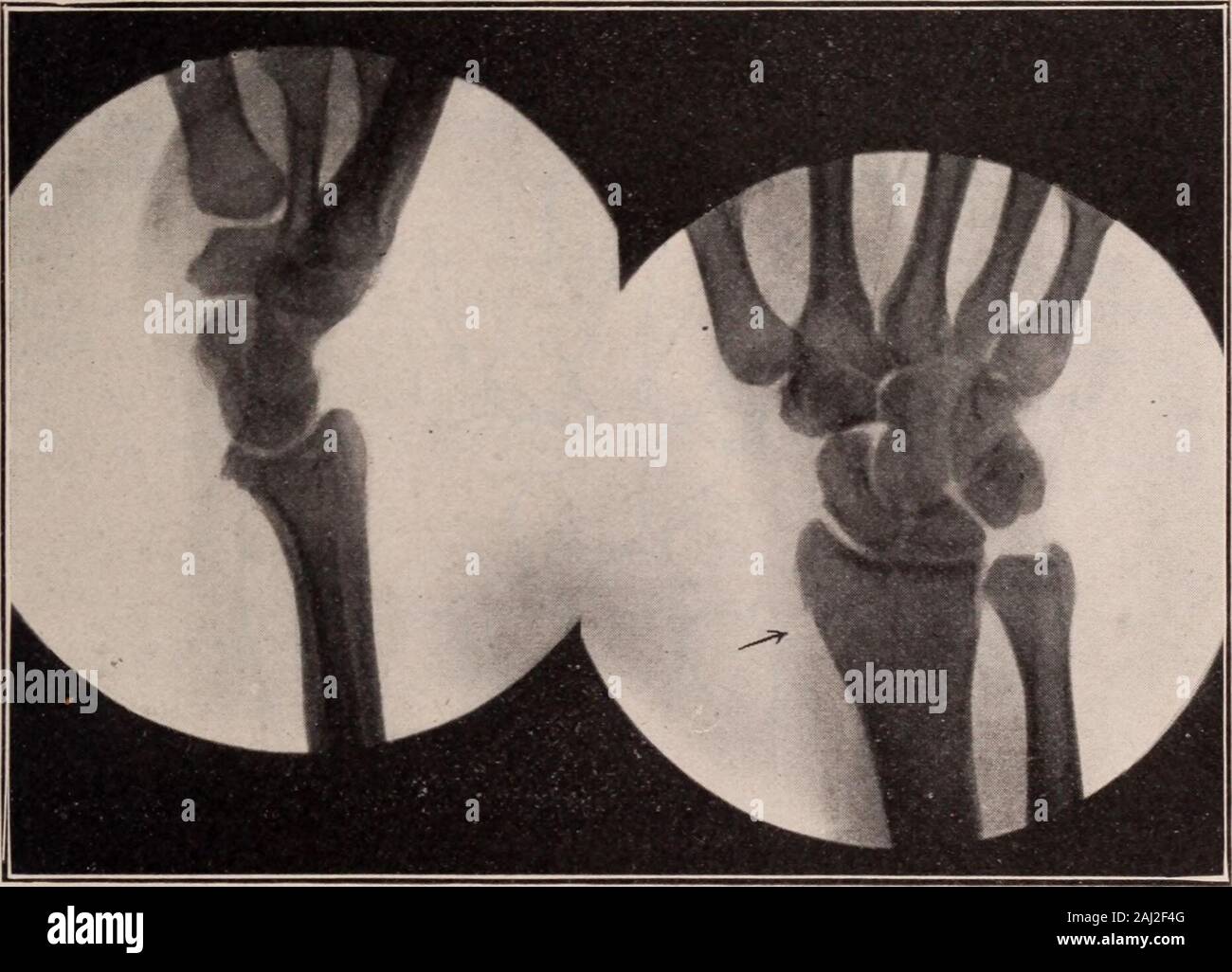 Sug triangular hi-res stock photography and images - Alamy