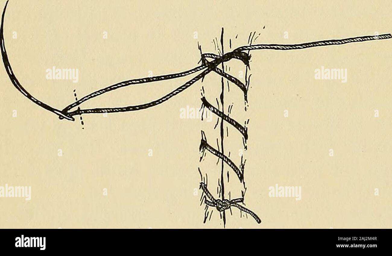 Operative surgery . Fig. 143.Continuous suture.. Fig. 143.—Tying ...