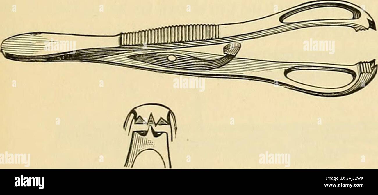 Operative surgery . FiG. 99.—Listons spring-catch fenestrated ...