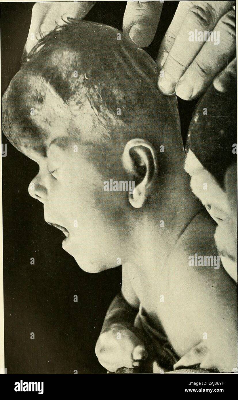 Gemellite hi-res stock photography and images - Alamy