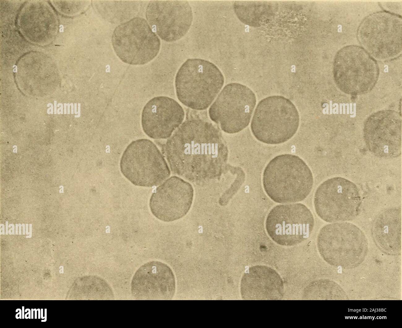 Induced cell-reproduction and cancer.. . Fig. 30.—Excited leucocytes ...