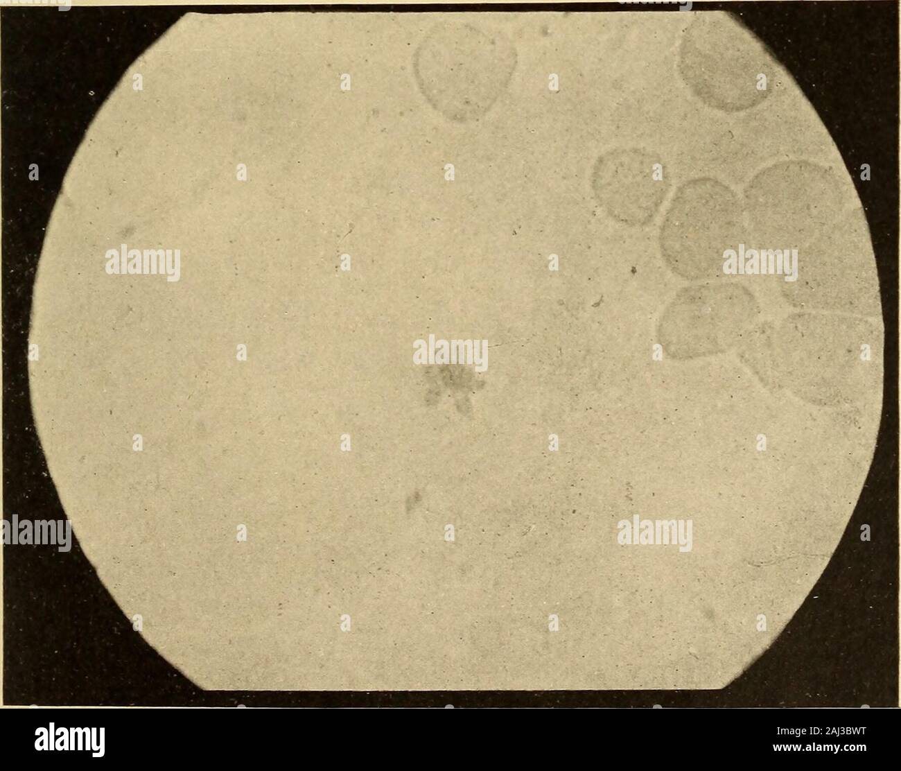 Induced cell-reproduction and cancer.. . Fig. 26 —An extruded ...