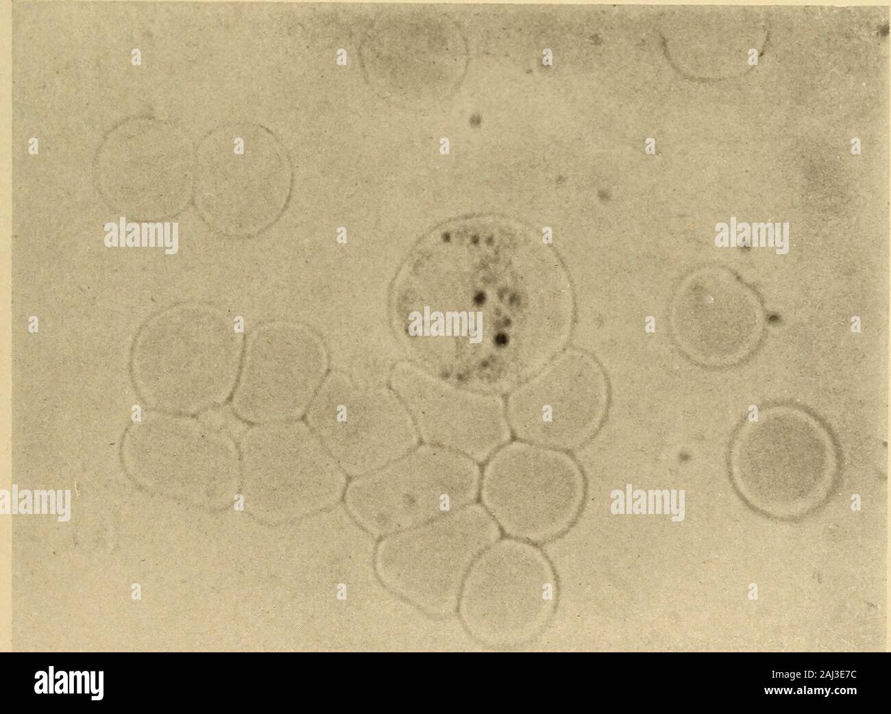 Induced cell-reproduction and cancer.. . Fig. 16.—A stained leucocyte ...