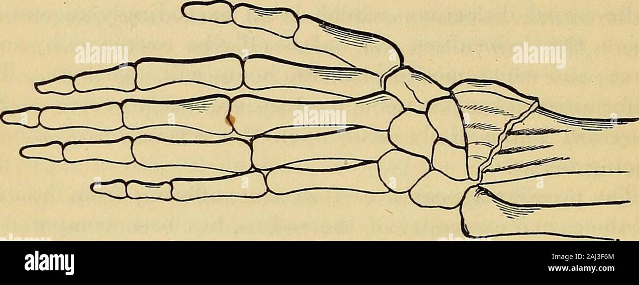 Sulcus sign hi-res stock photography and images - Alamy