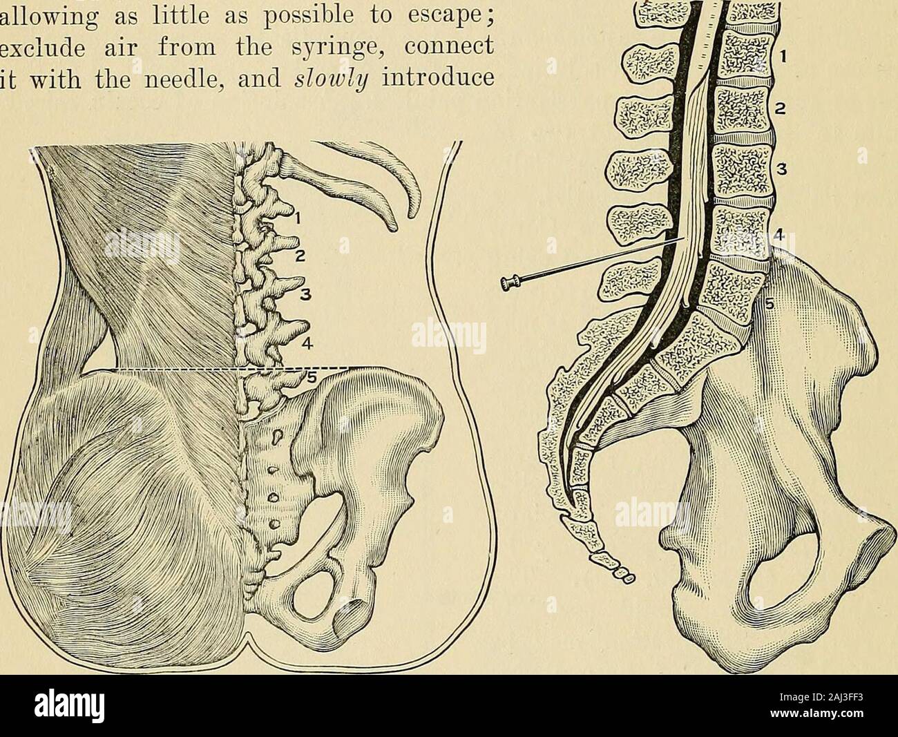 N 42 31 32 hi-res stock photography and images - Alamy