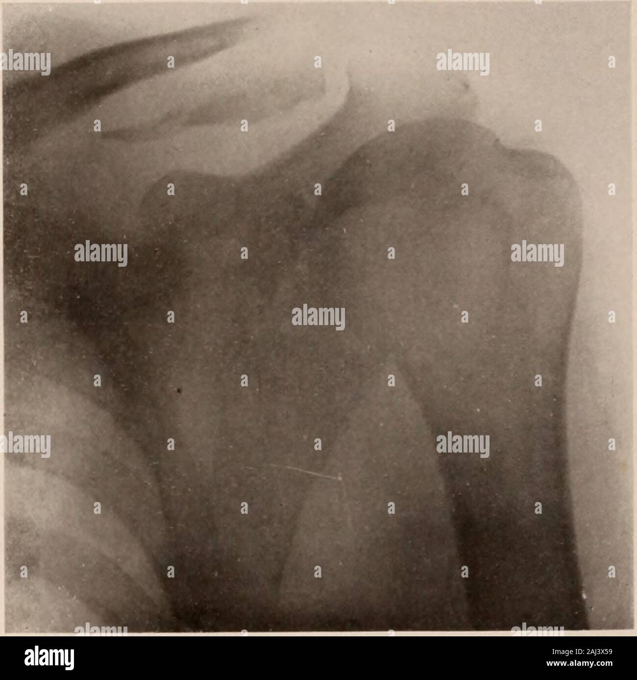 Anatomical distortion hi-res stock photography and images - Alamy