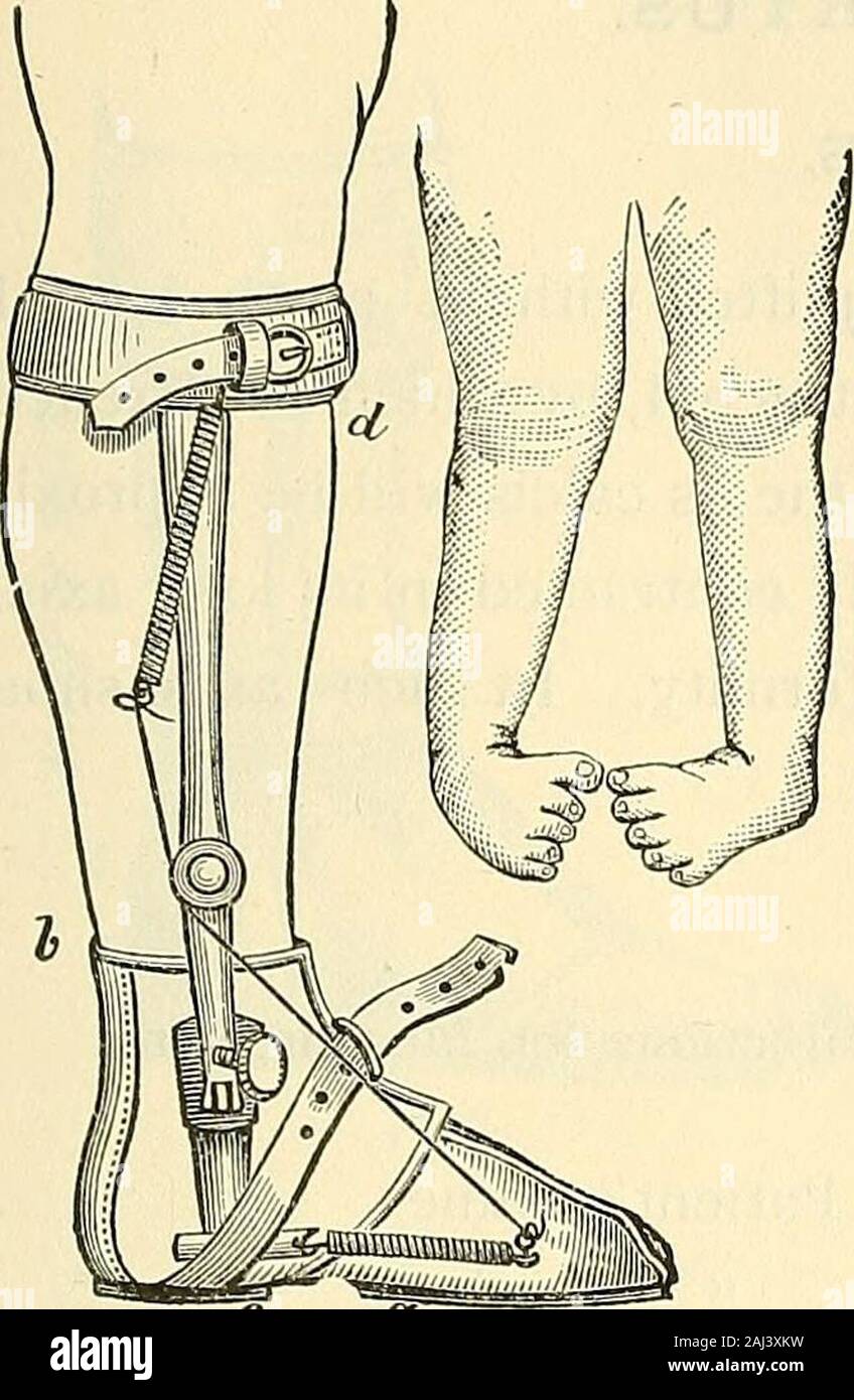 Calf measurement hi-res stock photography and images - Alamy