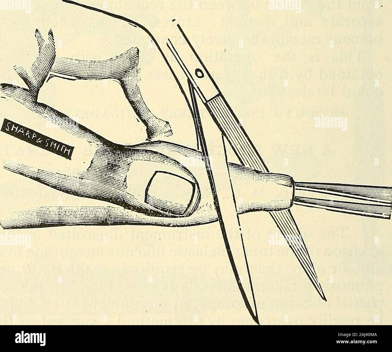 Varicocele hi-res stock photography and images - Alamy