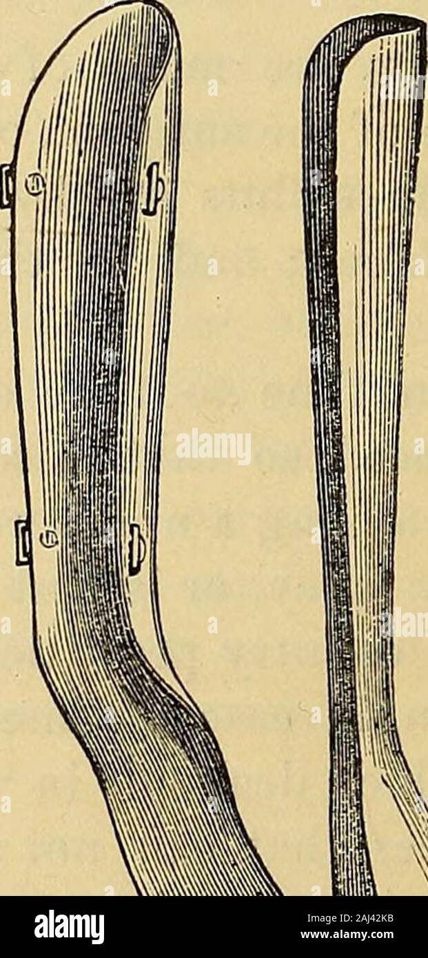 A practical and systematic treatise on fractures and dislocations ...