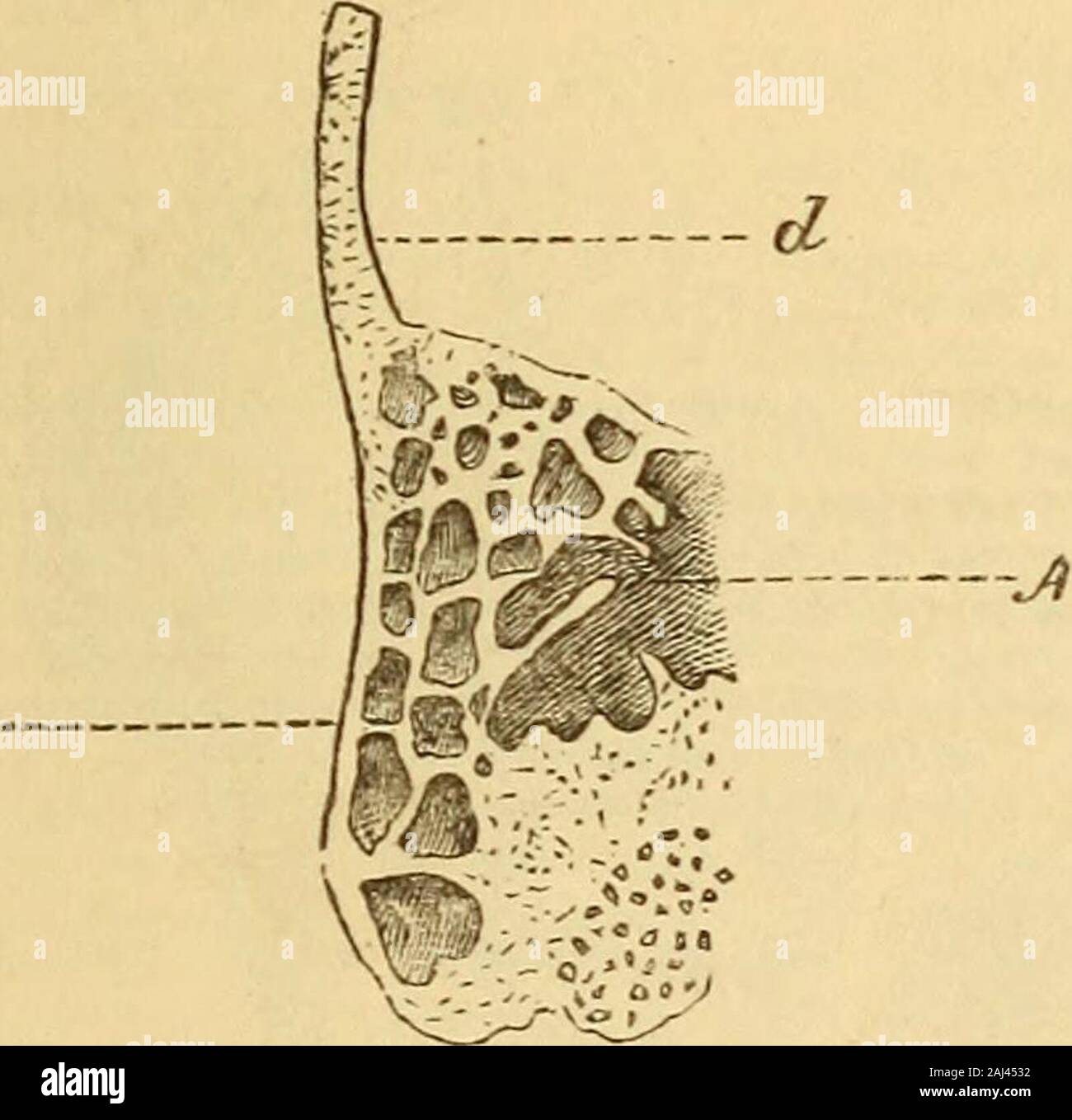 Inflammation of the outer ear hi-res stock photography and images - Alamy