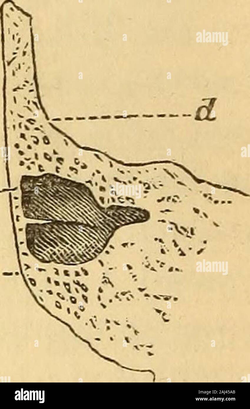 Mastoid air cells hi-res stock photography and images - Alamy
