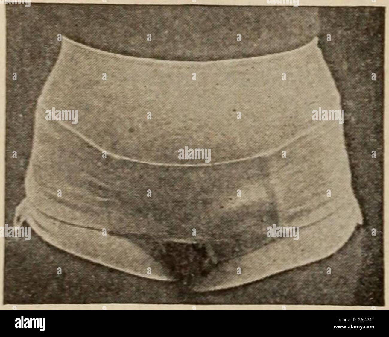 Endocrines hi-res stock photography and images - Alamy