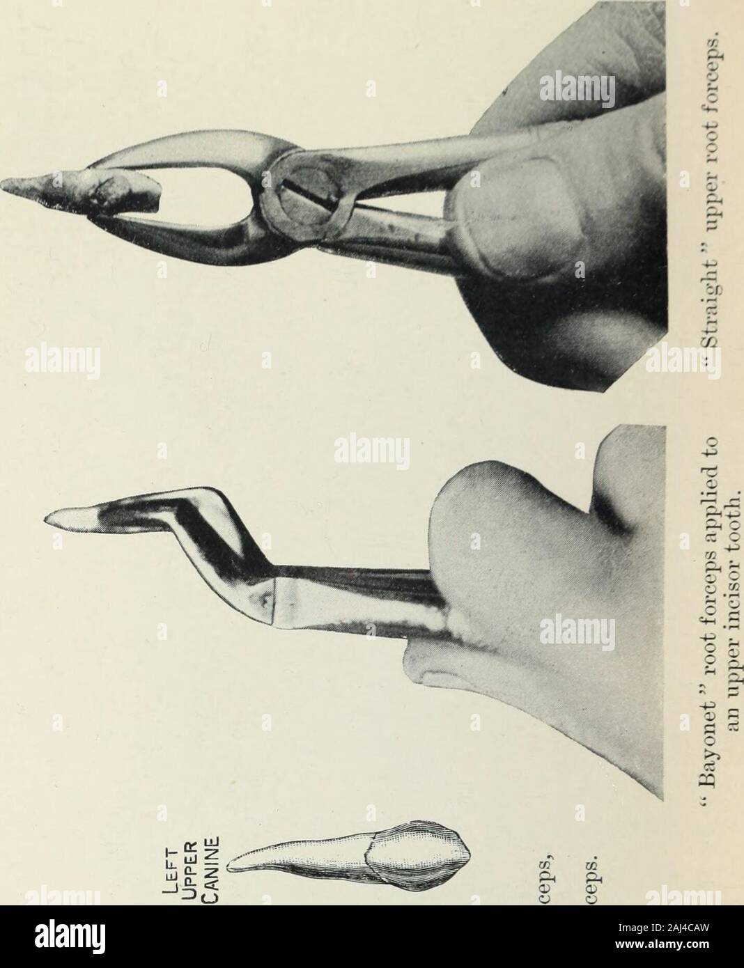 An atlas of dental extractions with notes on the causes and relief of ...