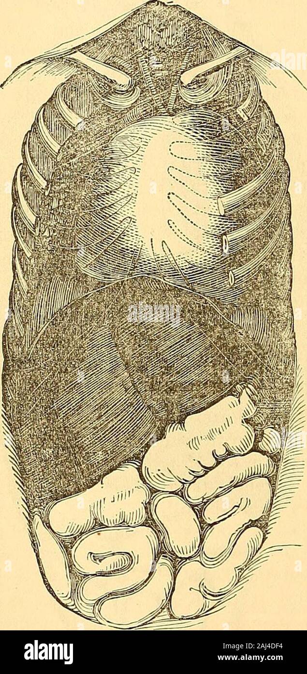 Epigastrium hi-res stock photography and images - Alamy