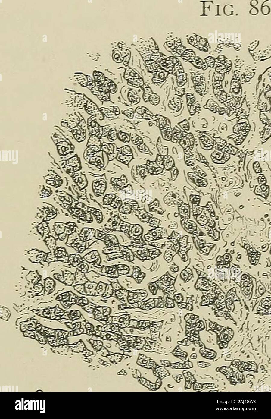 The origin of disease : especially of disease resulting from intrinsic ...