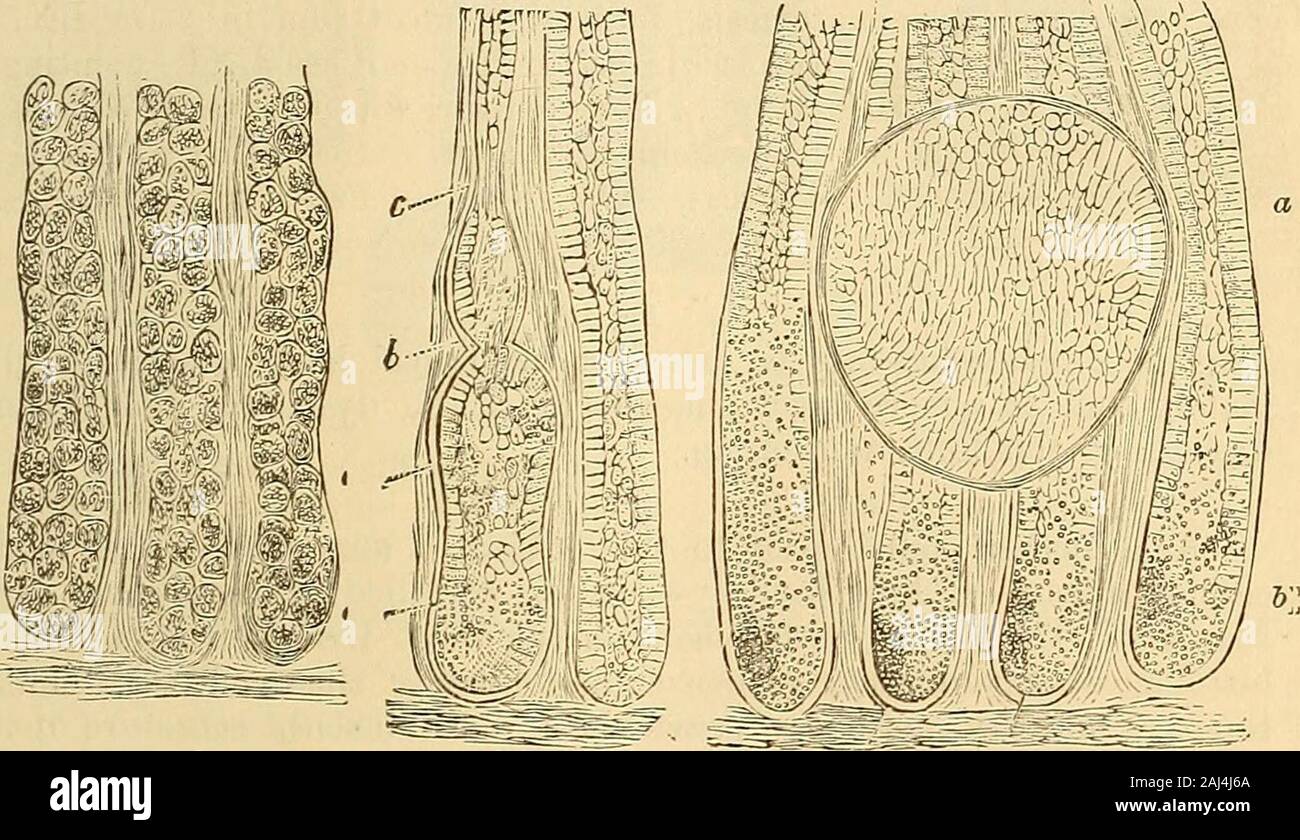 Epigastrium hi-res stock photography and images - Alamy