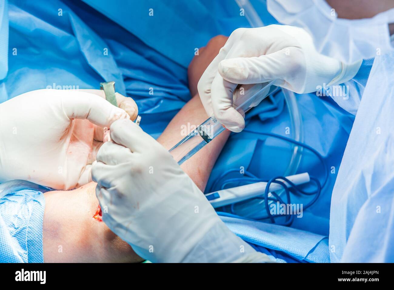 Group of surgeons performing an elbow surgery Stock Photo - Alamy