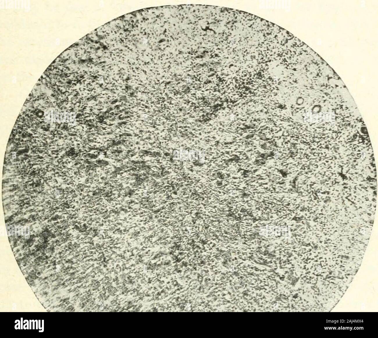 The Medical clinics of North America . Fig. 109.—Thyroid. Hyperplastic ...