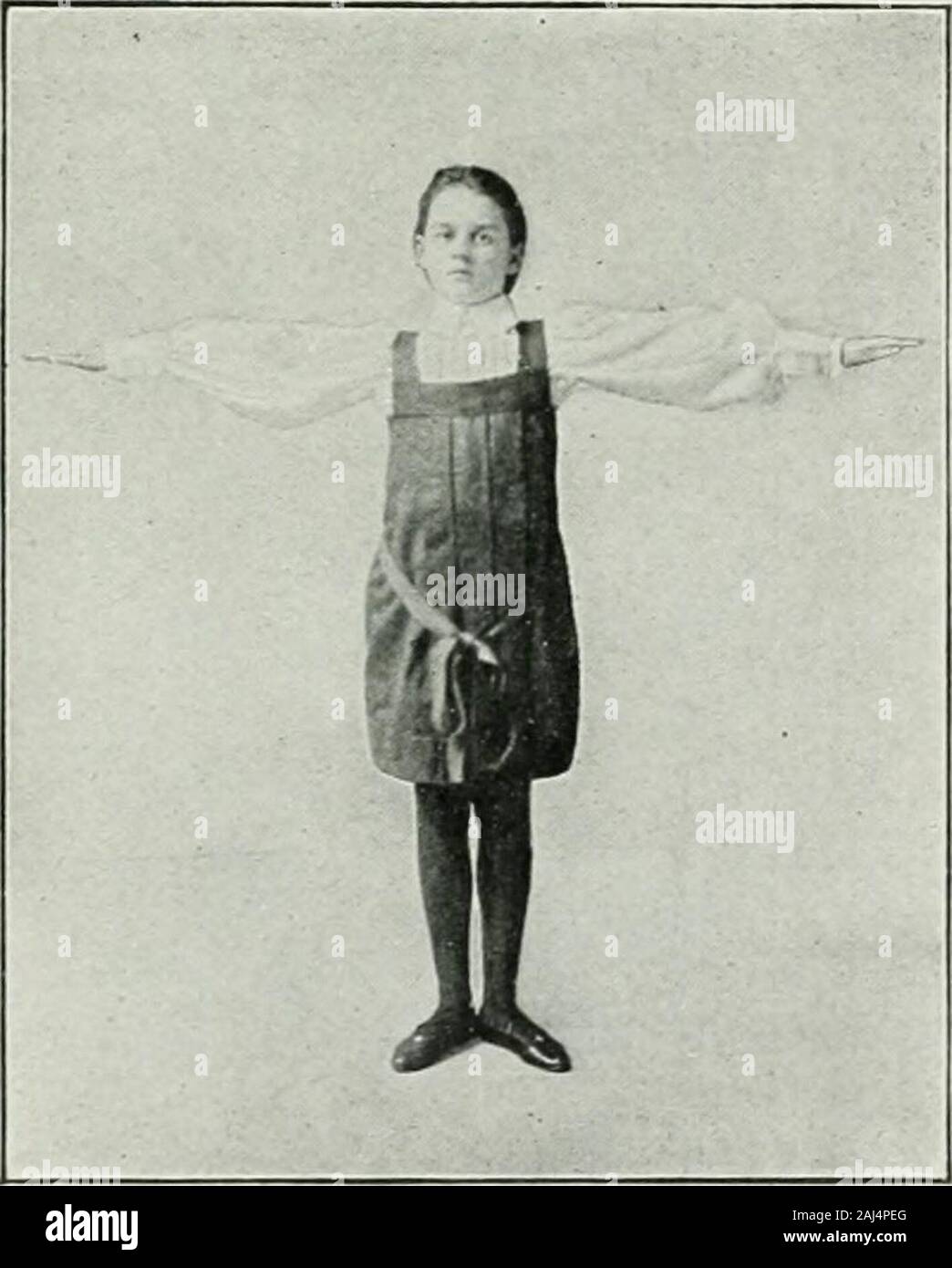 Trunk bending sideways hi-res stock photography and images - Alamy