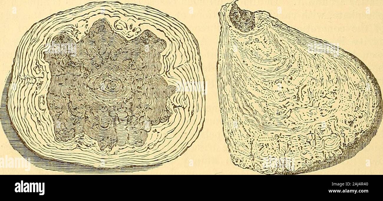 Clinical lectures on the principles and practice of medicine . Fig. 376 ...