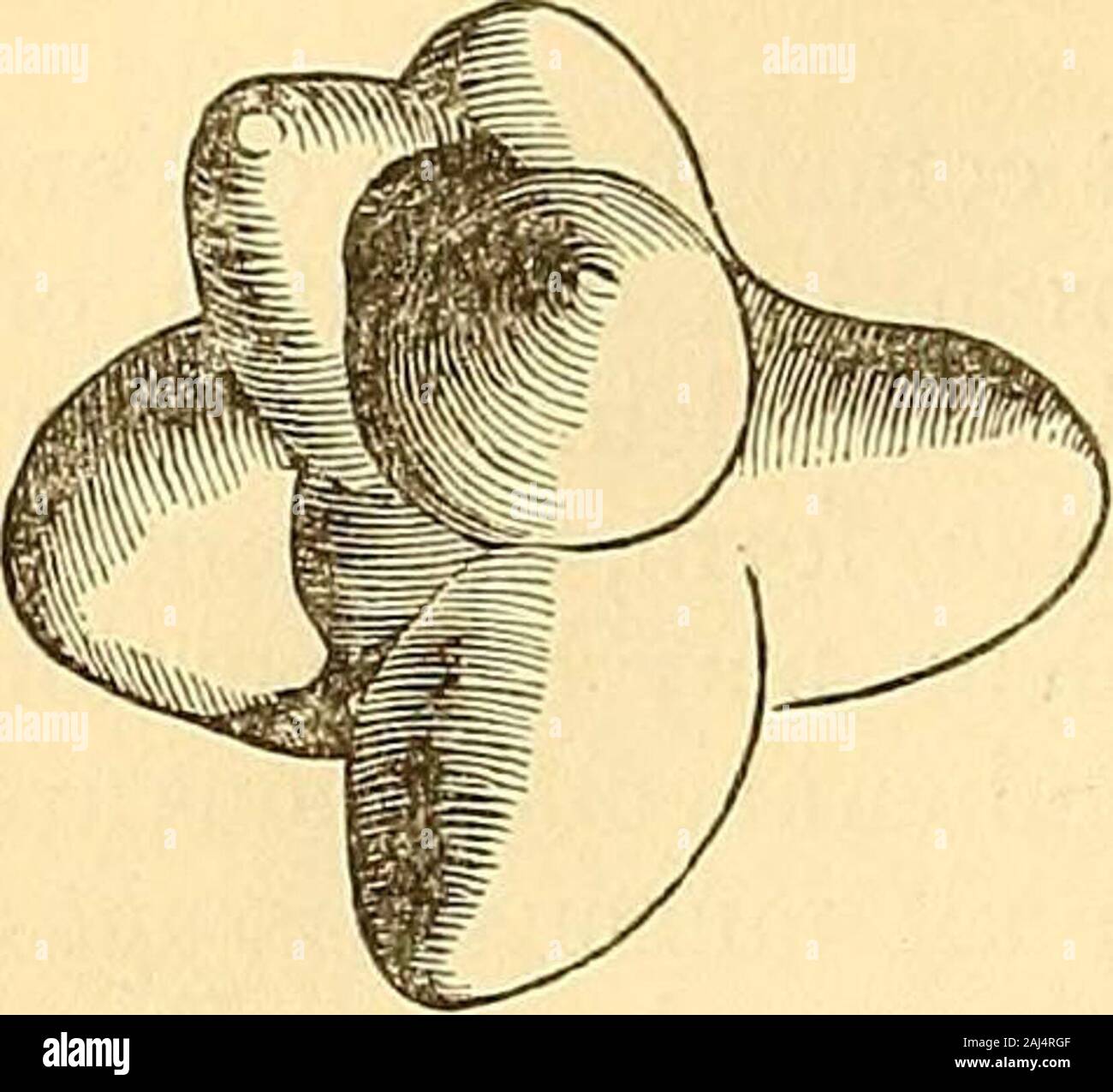 Pyelitis High Resolution Stock Photography and Images - Alamy