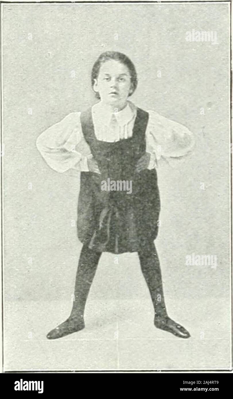 Trunk bending sideways hi-res stock photography and images - Alamy