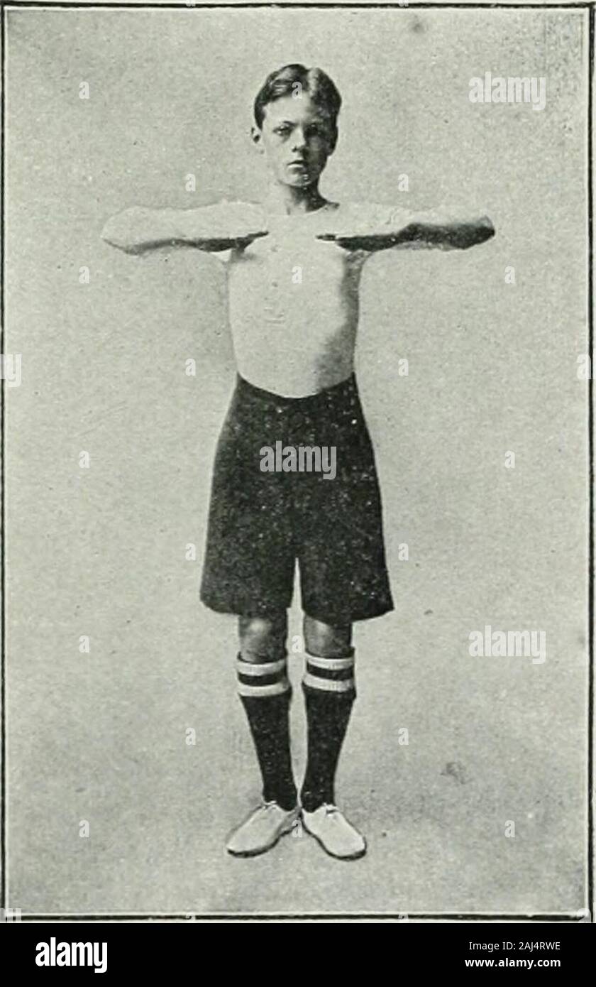 Trunk bending sideways hi-res stock photography and images - Alamy